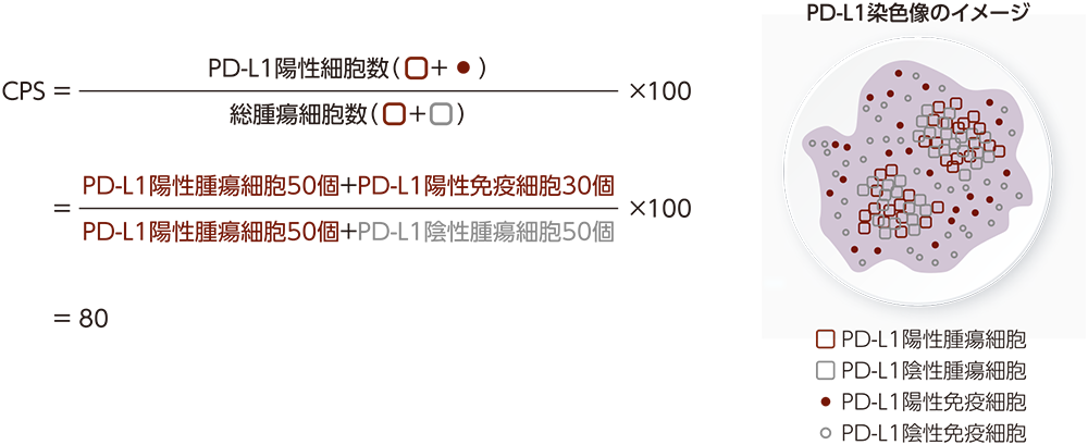 PD-L1検査の臨床的意義 ：子宮頸癌 | MSD Connect