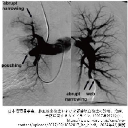 確定診断 | MSD Connect