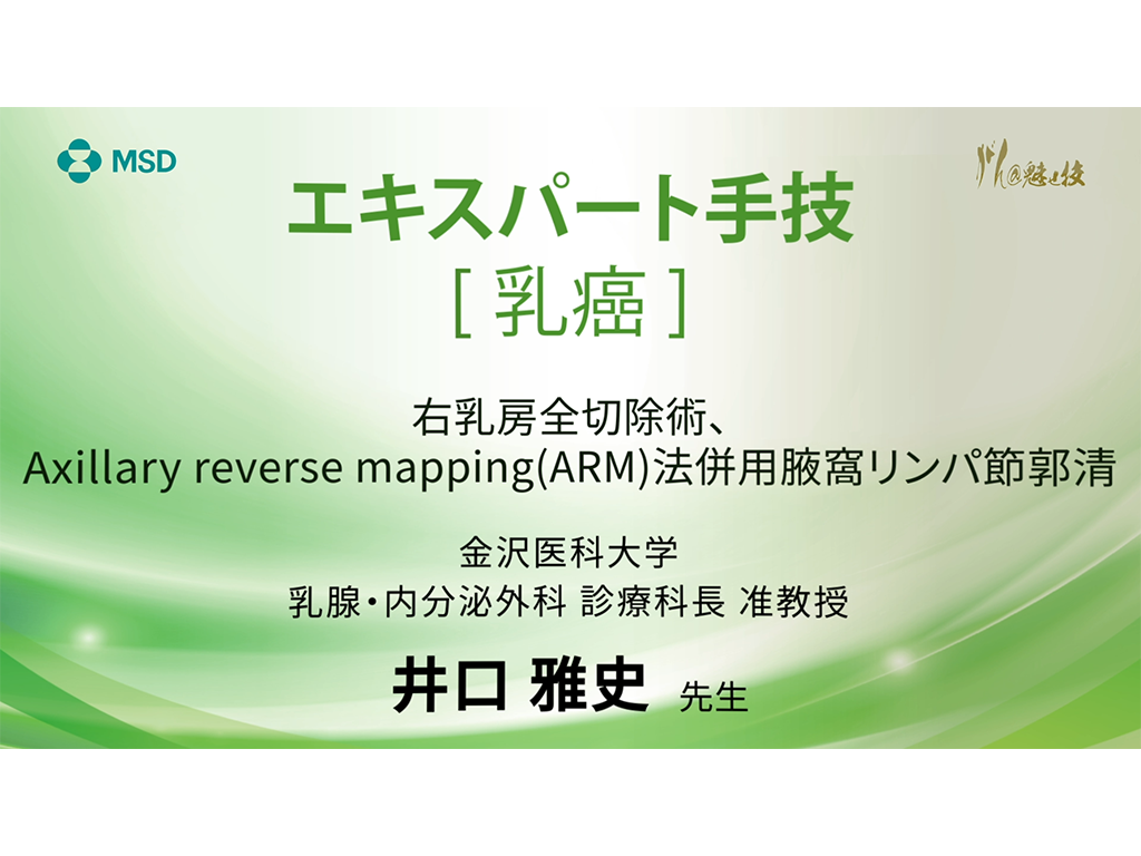 【乳癌】エキスパート手技 右乳房全切除術、Axillary reverse mapping（ARM）法併⽤腋窩リンパ節郭清 | MSD Connect
